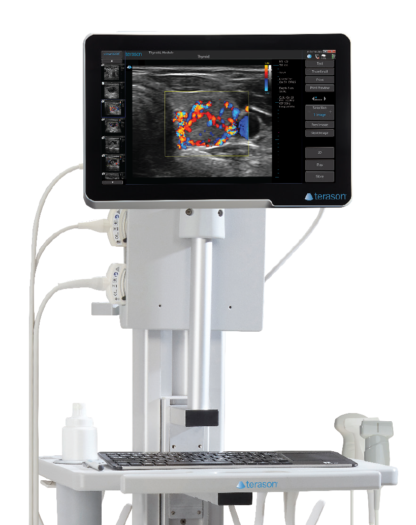 Terason USmart 3200T Plus Ultrasound System | Northern Diagnostics